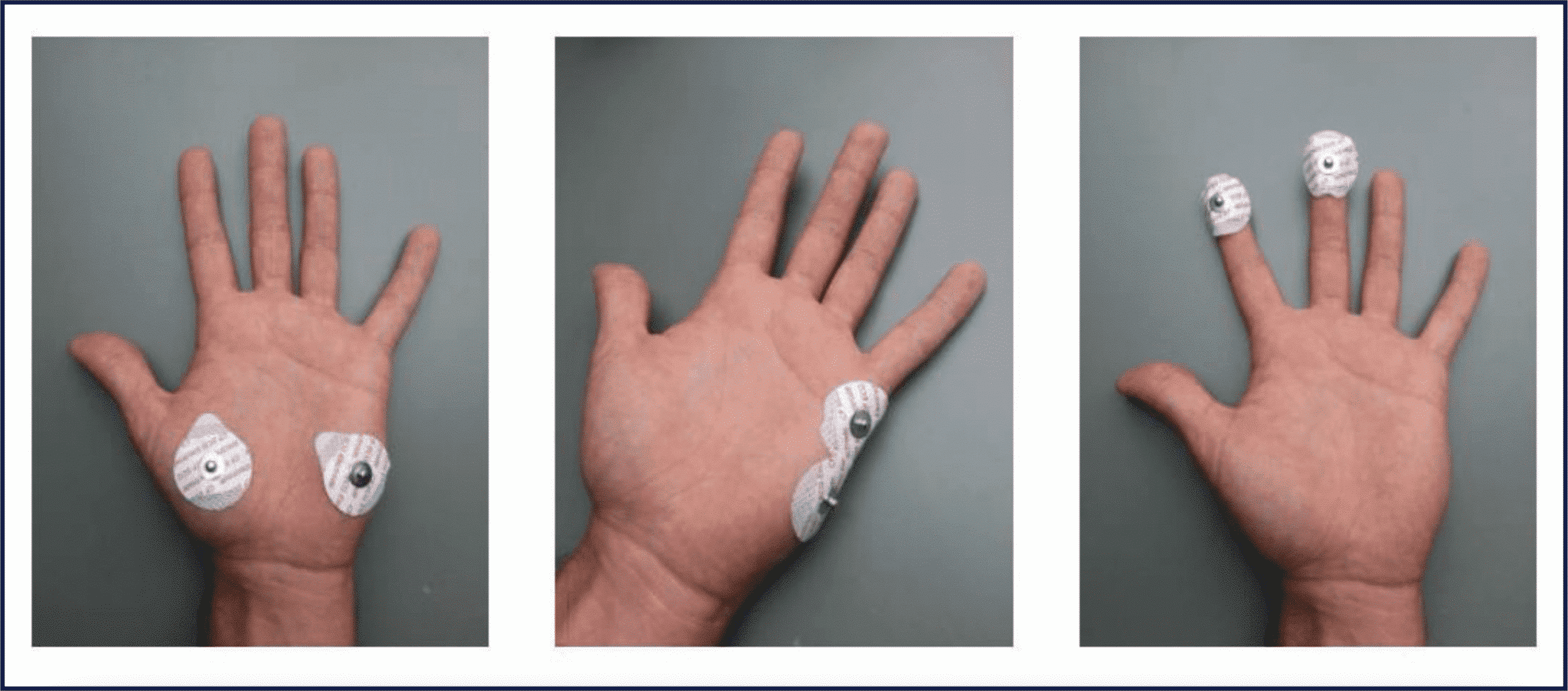 We recommend the single-use gel electrodes. There are three different ...